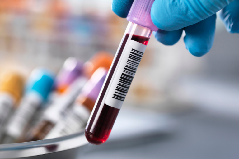 Chronic Kidney Disease 101: Lab Tests, Values Explained - Avoid ...