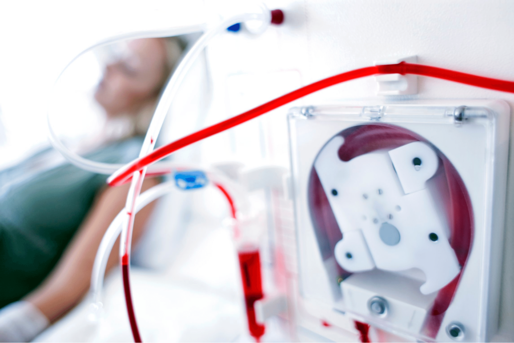 Dialysis, Demystified: Comparing Peritoneal dialysis and Hemodialysis ...