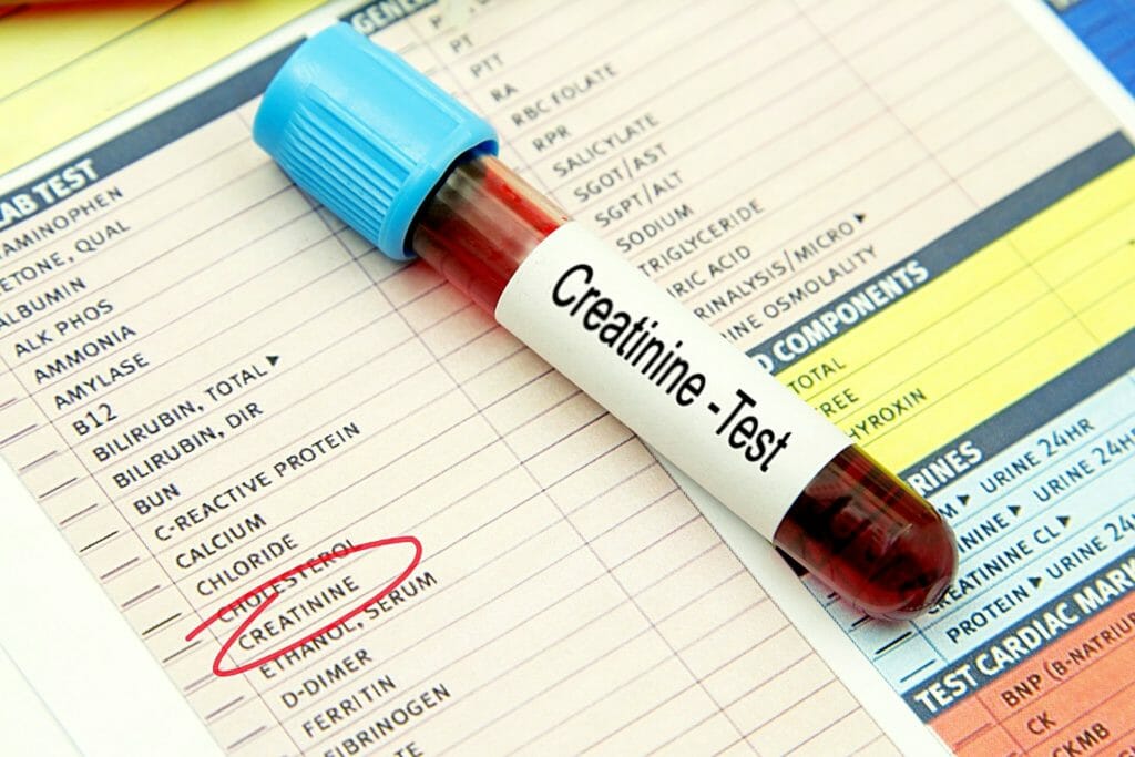Creatinine and Kidney Function: What You Need to Know - Avoid dialysis ...