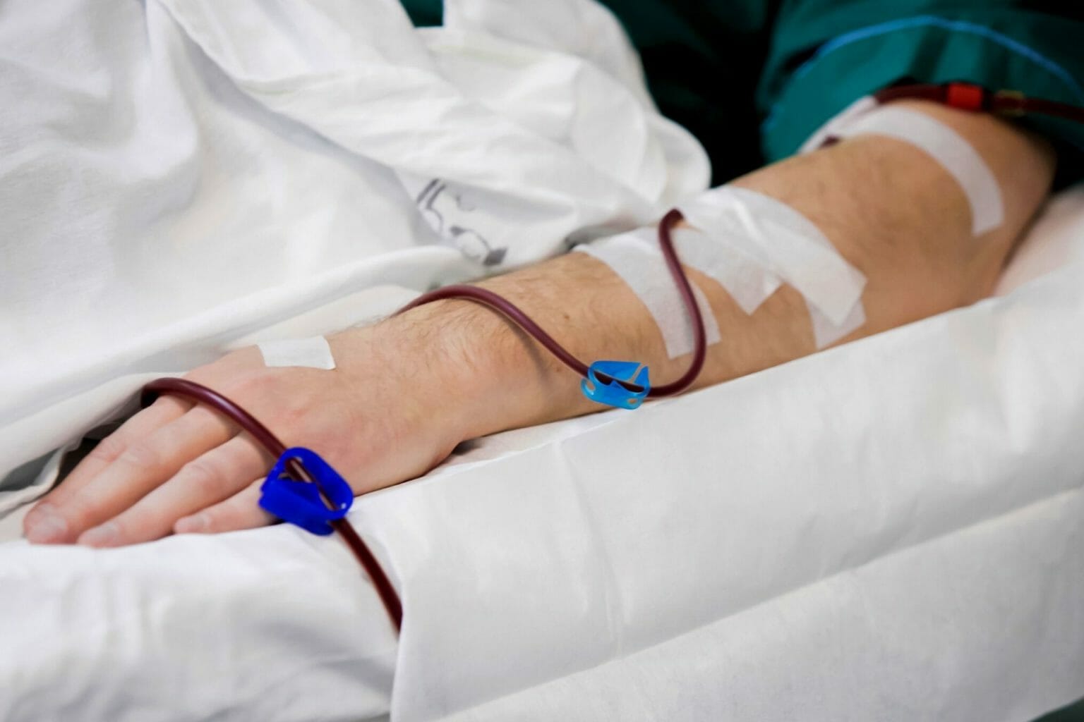 At Home Dialysis Treatment: Family as Informal Caregivers - Avoid ...