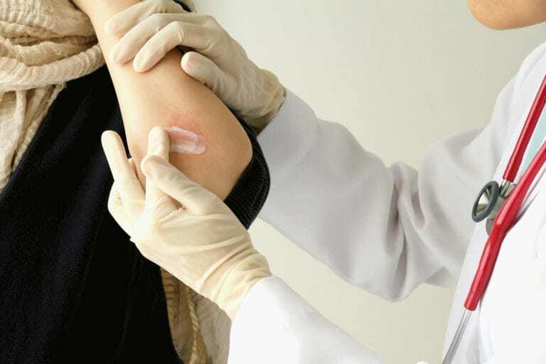 Skin Problems in CKD: How Kidney Disease Affects the Skin - Avoid ...