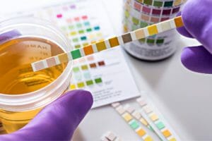 Protein in the Urine: Causes and Treatment | RenalTracker Blog - Avoid ...