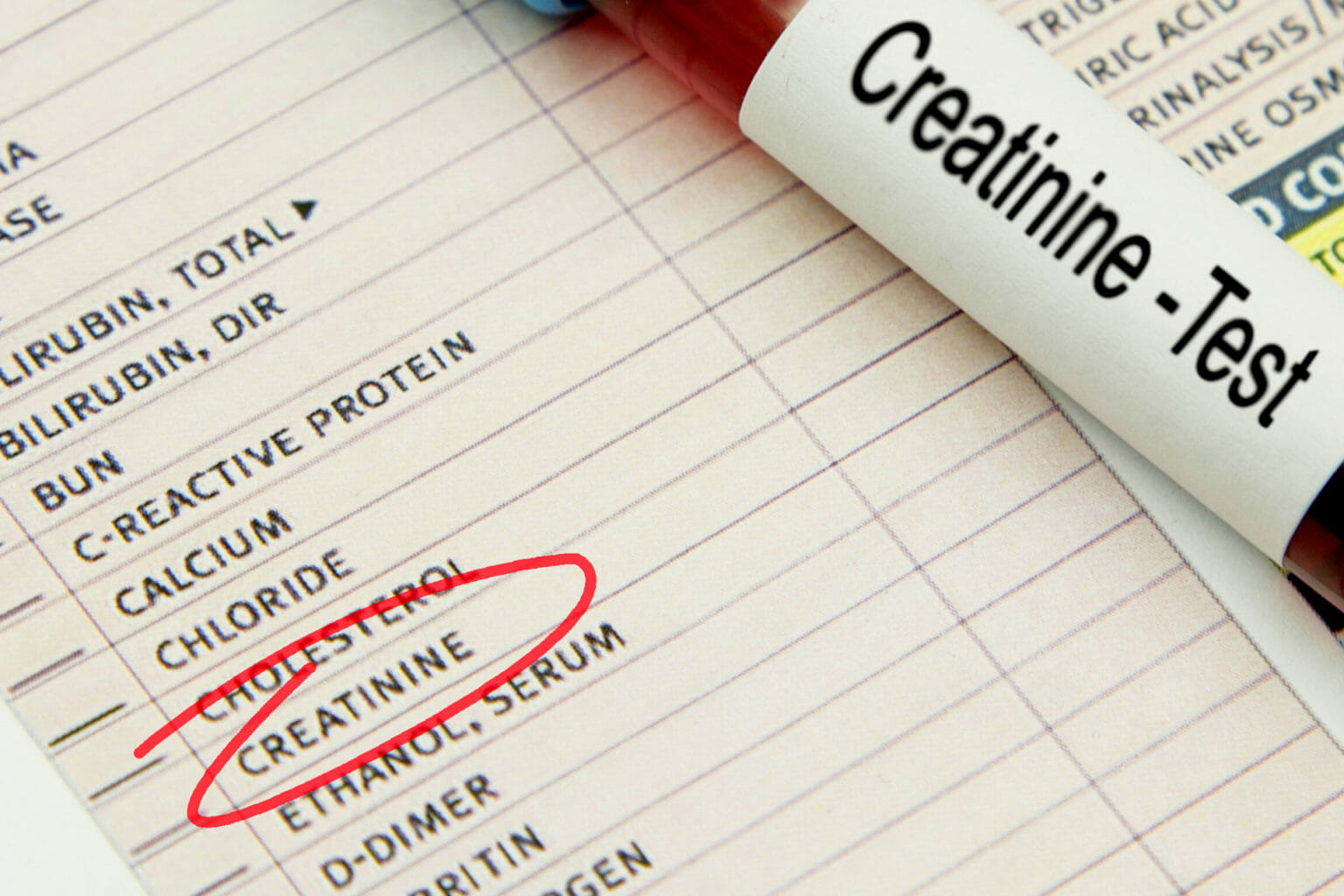 CKD Foods to Lower Creatinine Level - Avoid dialysis through diet and ...